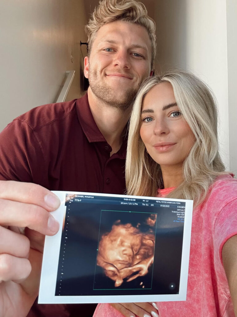 Olympic medalist MyKayla Skinner awaiting birth of first child