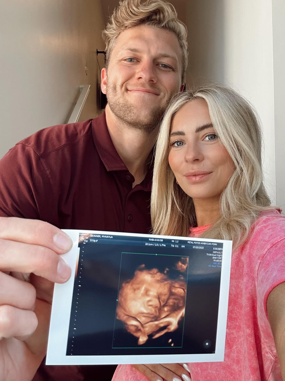 Olympic medalist MyKayla Skinner awaiting birth of first child